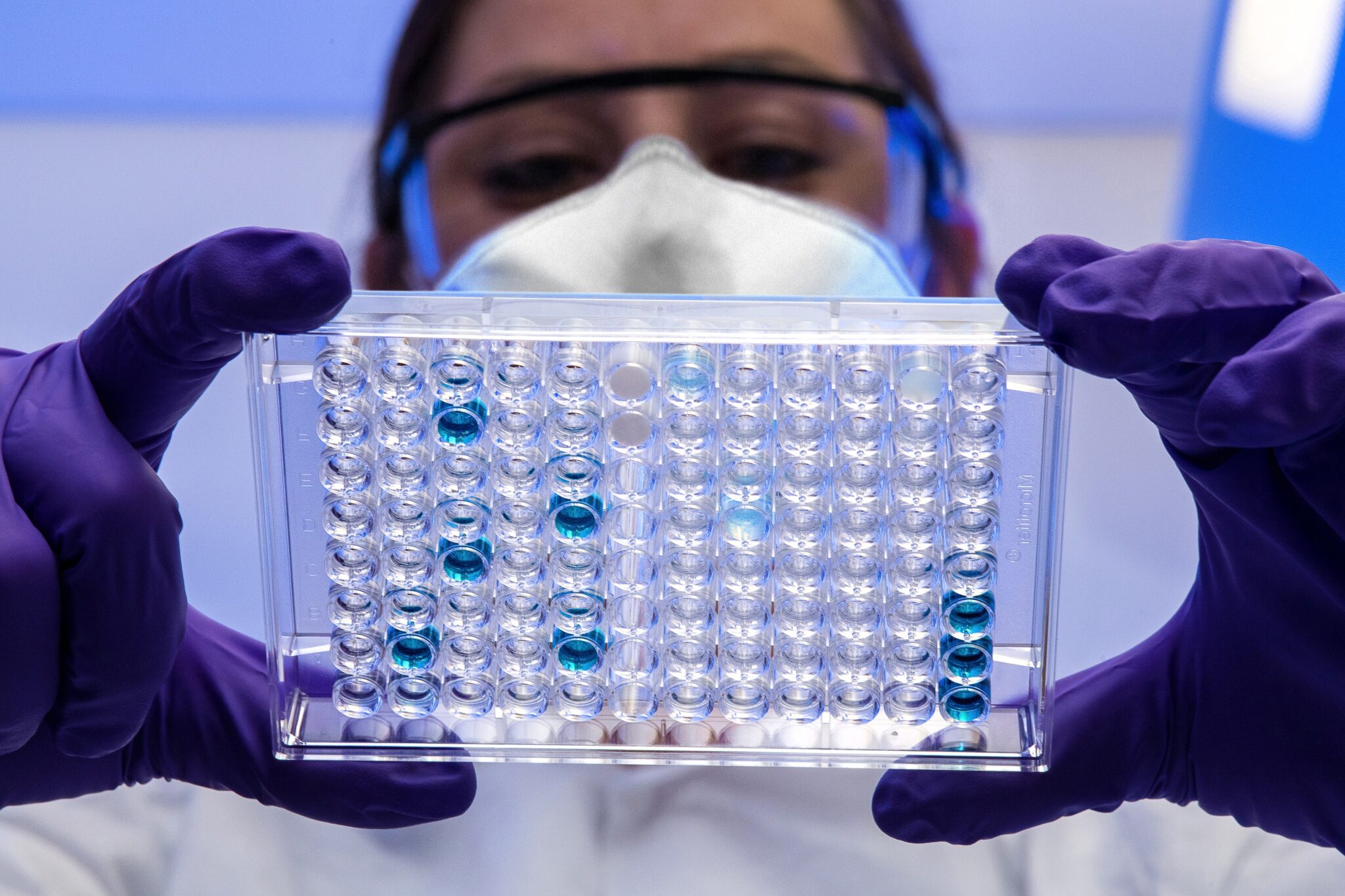 Pros and Cons of Preimplantation Genetic Screening (PGS)